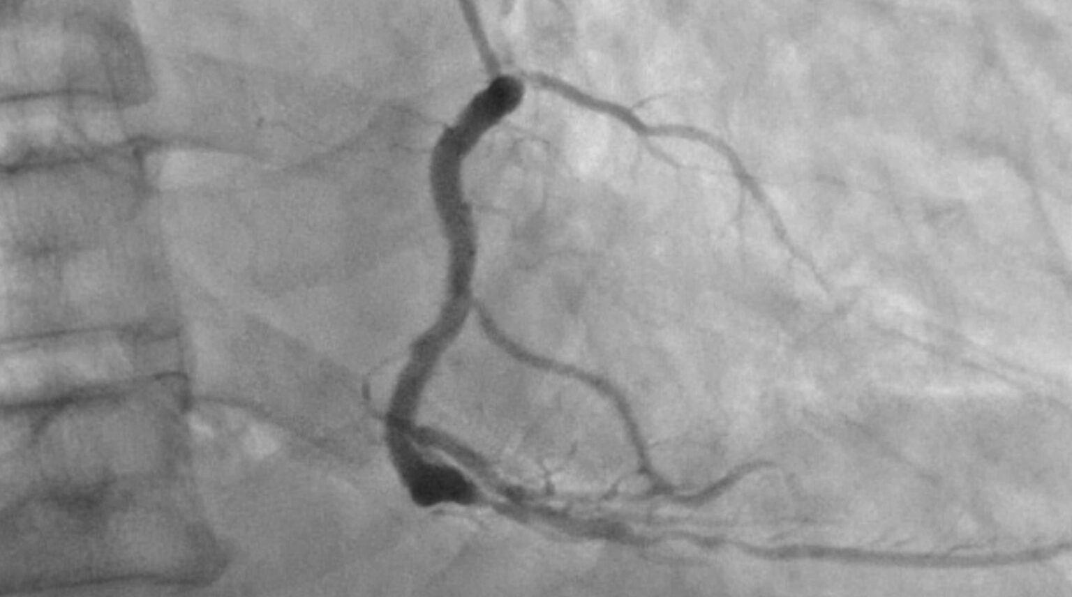 Home - Cardiac Wire