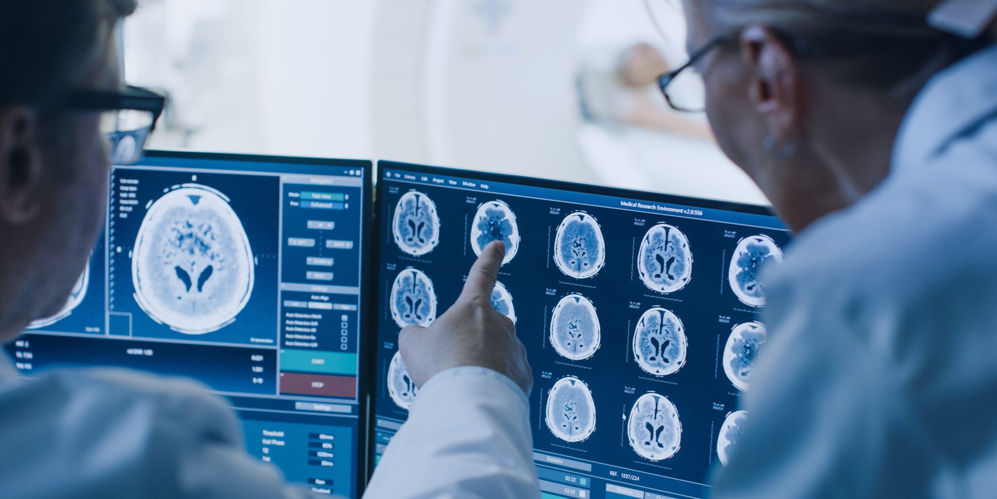 AI for Brain MRI - The Imaging Wire