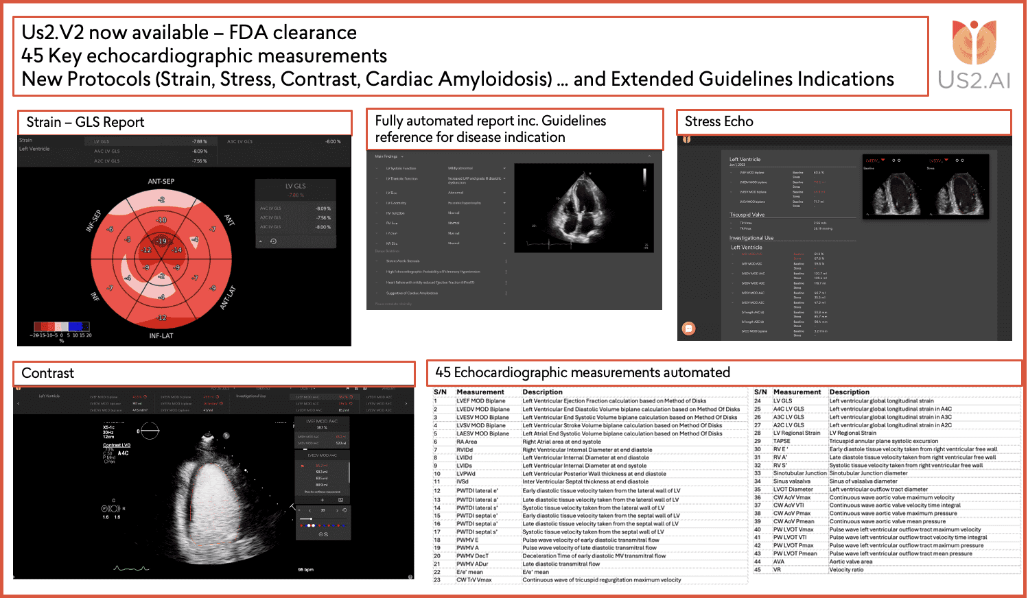 Advances in AI-Automated Echocardiography with Us2.ai - The Imaging Wire